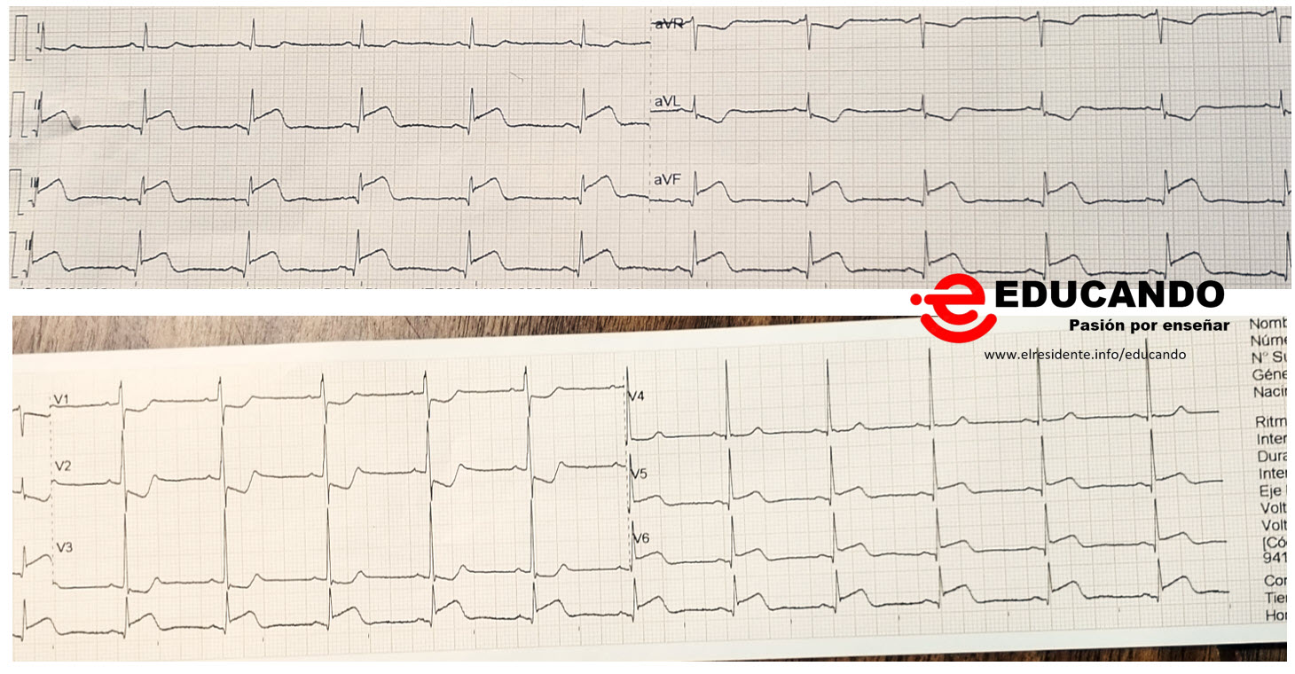 ECG 18-06-2024 - Educando