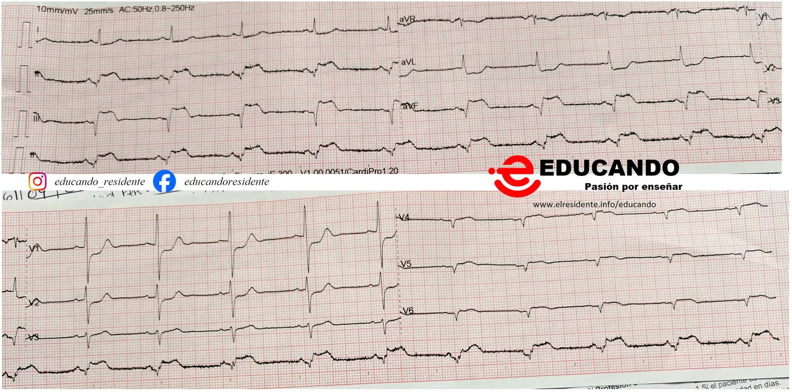 ECG 03-09-2024 - Educando